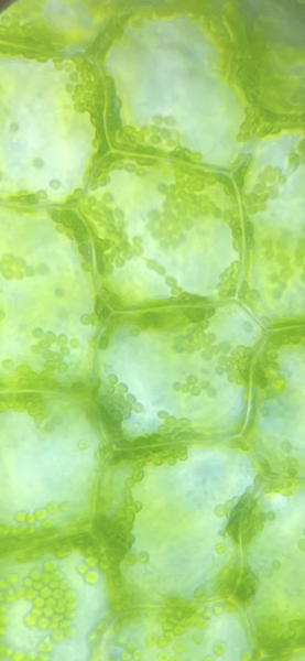 NW in Jahrgang 7: Zellen der Wasserpest unter dem Mikroskop